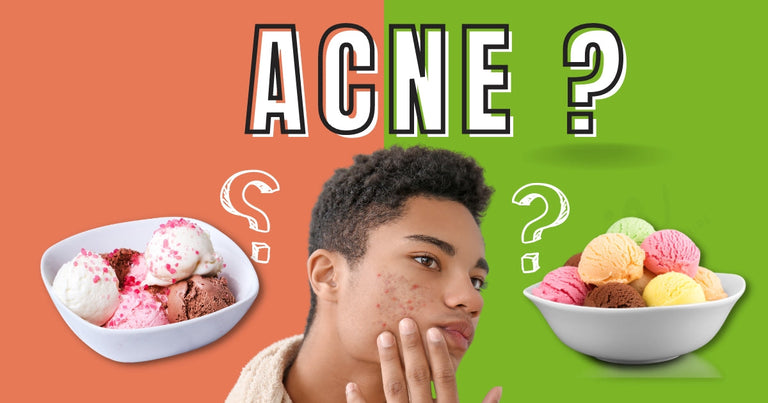 Does Ice Cream cause Acne? – Nature4Nature